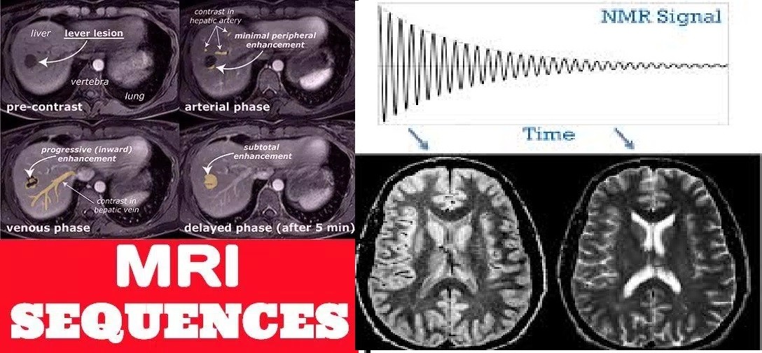 What is the difference between MRI Sequences and MRI series? - Blogs